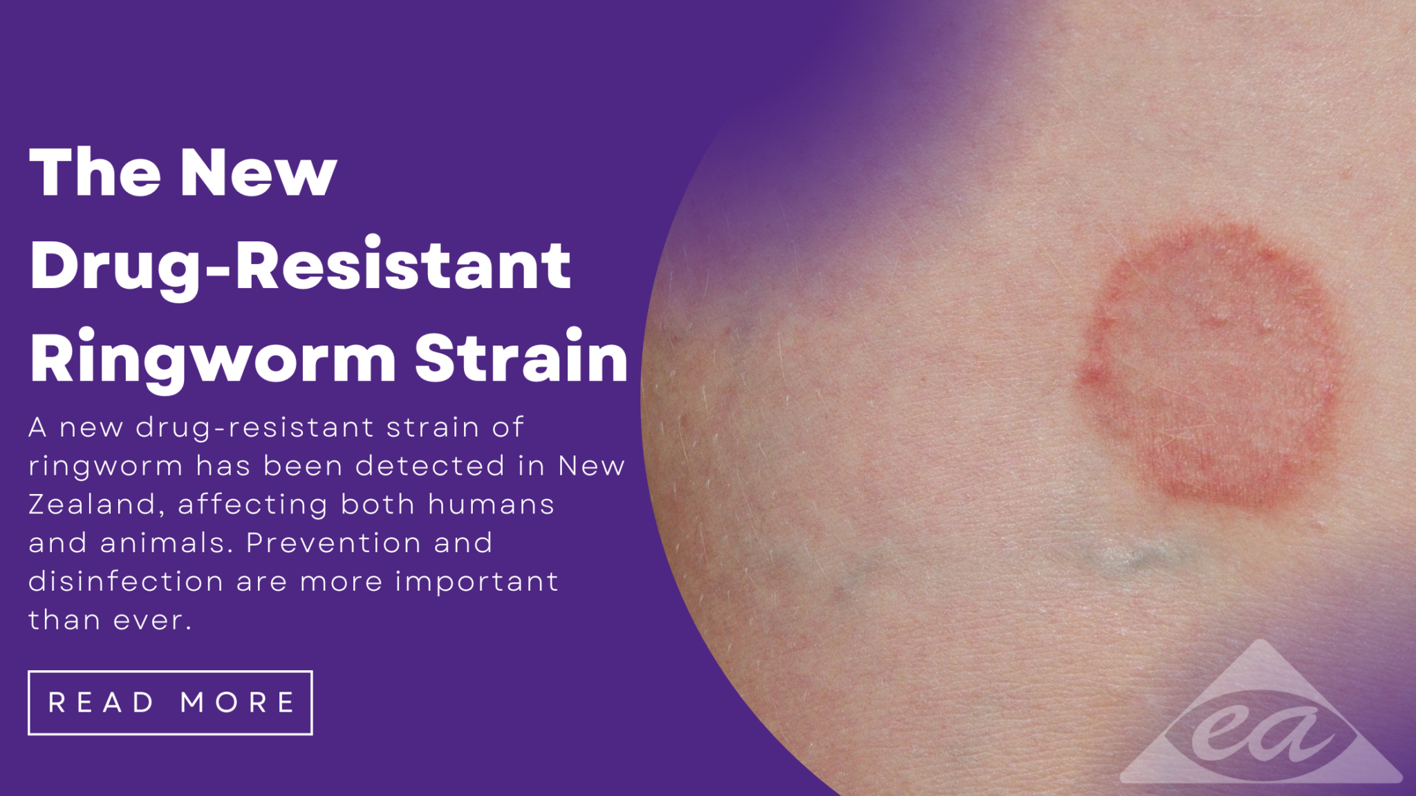 Combatting the New Drug-Resistant Ringworm Strain: Protecting Humans ...